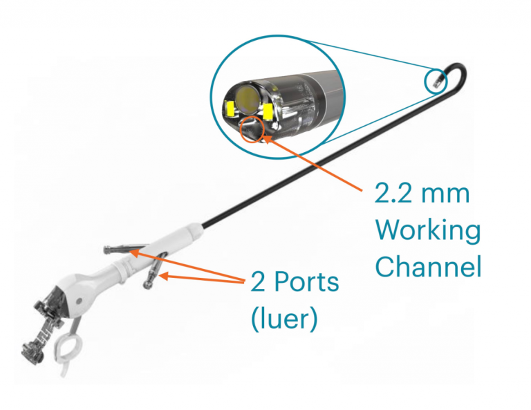 UroViu Fully Deflectable Single-Use Cystoscope